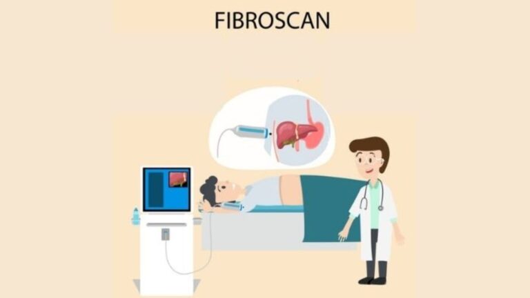 What is a Fibroscan and How Does it Work?
