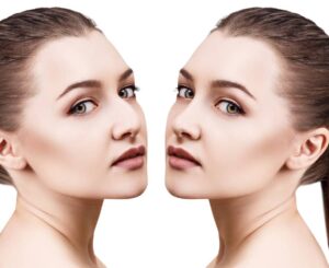 Unveiling the Majesty of the Roman vs Aquiline Nose